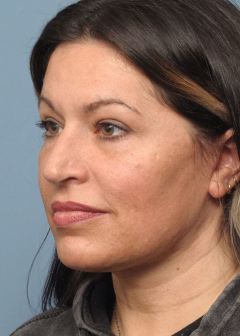 COMPLETE GUIDE TO V-FACE SCULPTING - AIREM