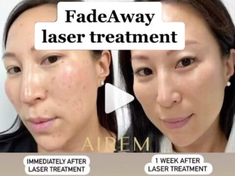 FadeAway Long Island, NY | Queens FadeAway